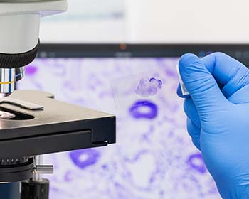 MUIB | Master’s Degree in Biomedical Engineering | UPV